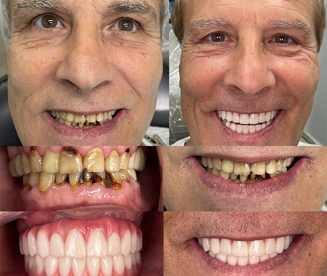 Life Changing Smiles – OneSolution®